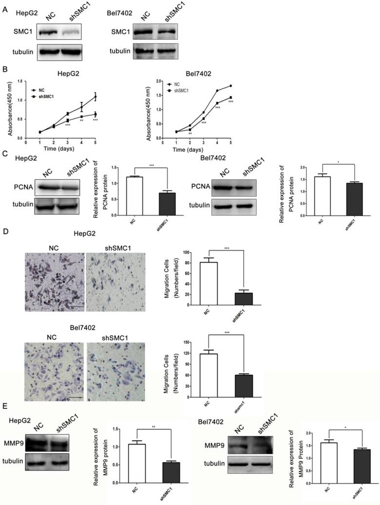 Phosphorylation of SMC1A promotes hepatocellular carcinoma cell ...