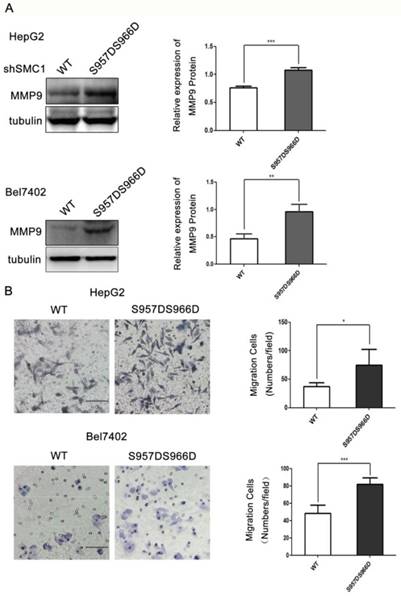 Phosphorylation of SMC1A promotes hepatocellular carcinoma cell ...