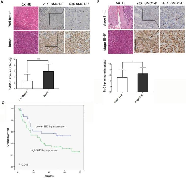 Phosphorylation of SMC1A promotes hepatocellular carcinoma cell ...