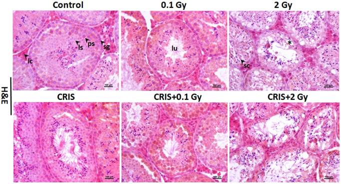 Apoptosis Induction by Iron Radiation via Inhibition of Autophagy in ...