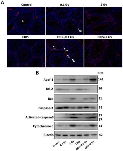Apoptosis Induction by Iron Radiation via Inhibition of Autophagy in ...