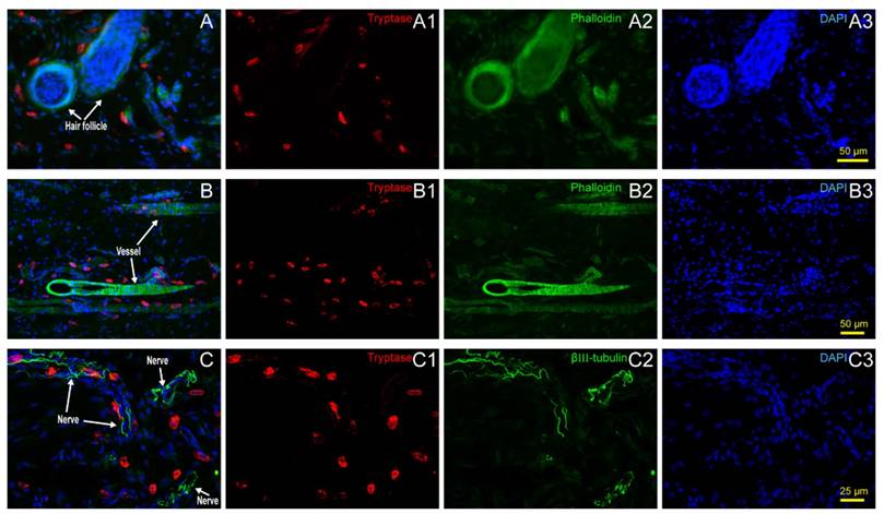 An investigation of the distribution and location of mast cells ...