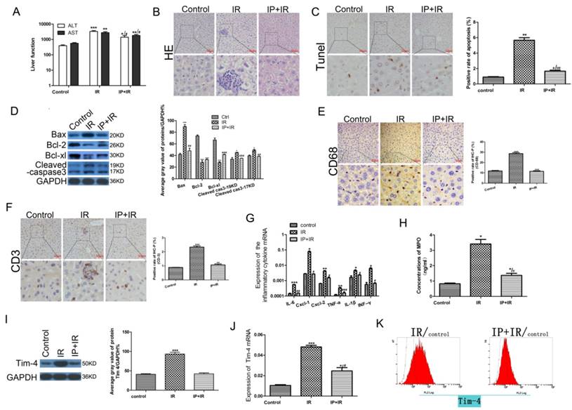 Hepatic Ischemic Preconditioning Alleviates Ischemia-Reperfusion Injury ...