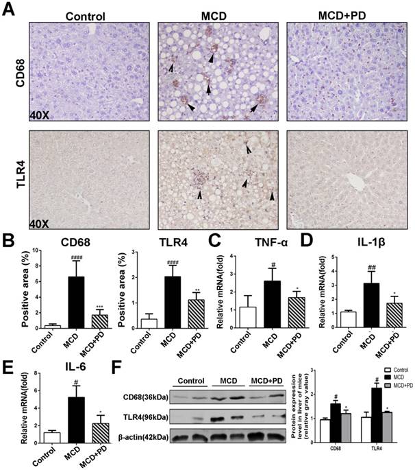 Polydatin attenuates diet-induced nonalcoholic steatohepatitis and ...