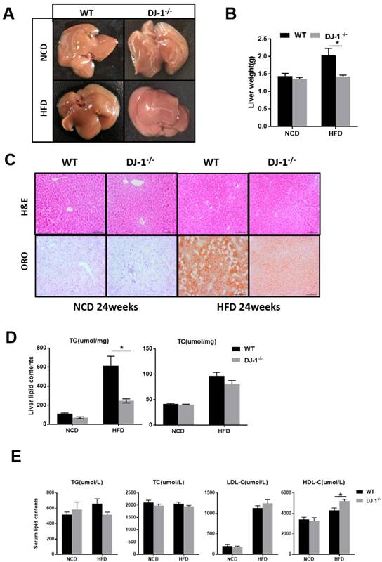 DJ-1 Deficiency Protects Hepatic Steatosis by Enhancing Fatty Acid ...