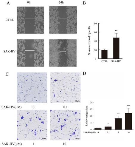 SAK-HV Promotes RAW264.7 cells Migration Mediated by MCP-1 via JNK and ...