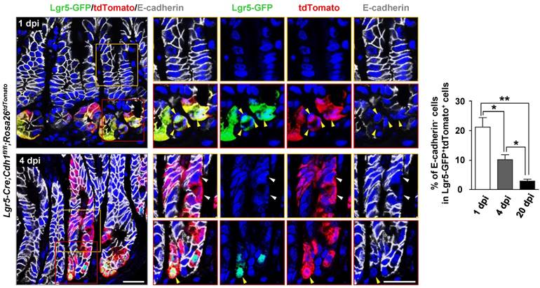 E-cadherin is Required for the Homeostasis of Lgr5+ Gastric Antral Stem ...
