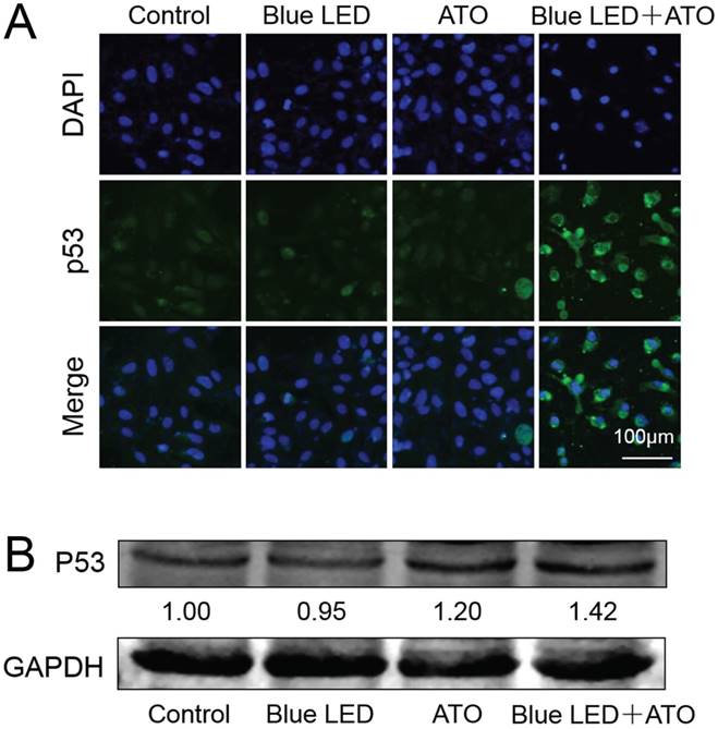 Synergistic anti-tumor effects of arsenic trioxide and blue LED ...