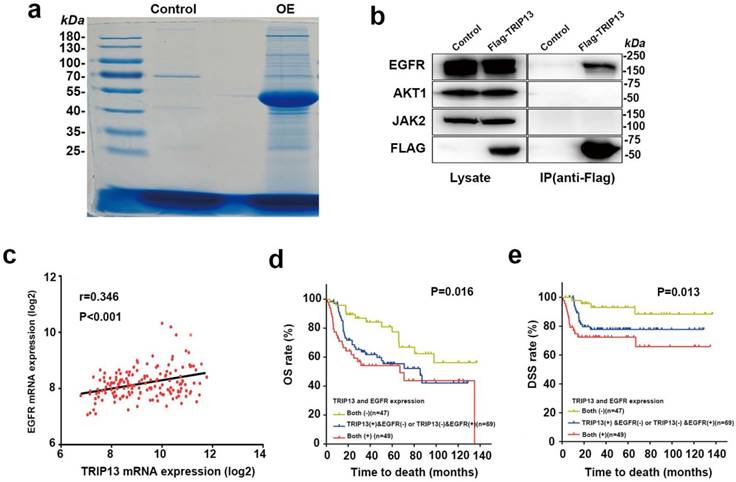 Increased expression of TRIP13 drives the tumorigenesis of bladder ...