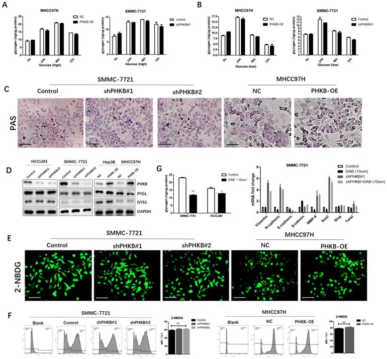 Phosphorylase Kinase β Represents a Novel Prognostic Biomarker and ...