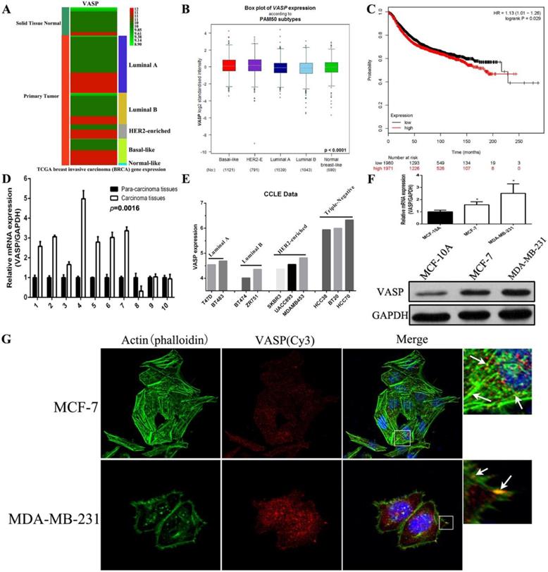 CREB1/Lin28/miR-638/VASP Interactive Network Drives the Development of ...
