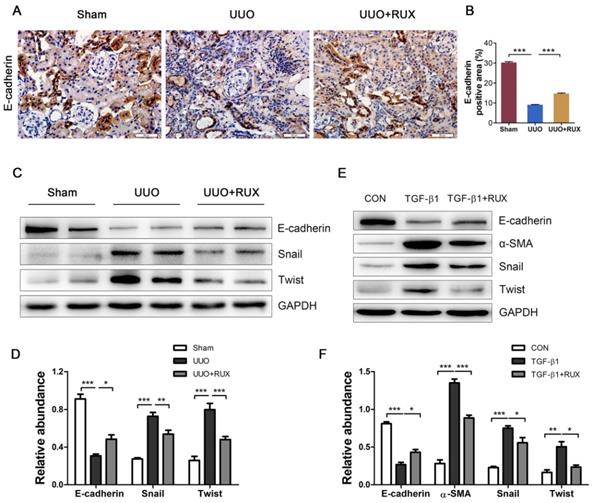 Ruxolitinib Alleviates Renal Interstitial Fibrosis in UUO Mice