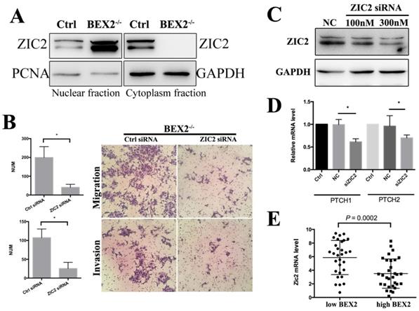 Silencing of brain-expressed X-linked 2 (BEX2) promotes colorectal ...