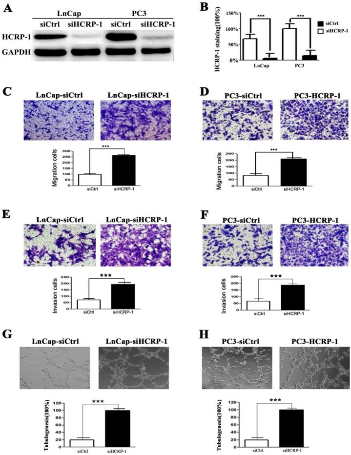 HCRP-1 regulates cell migration, invasion and angiogenesis via Src/ FAK ...