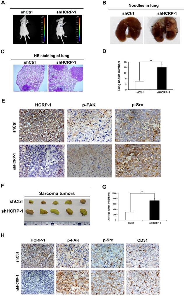HCRP-1 regulates cell migration, invasion and angiogenesis via Src/ FAK ...