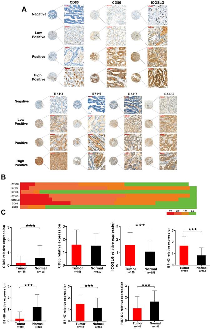 Comprehensive understanding of B7 family in gastric cancer: expression ...