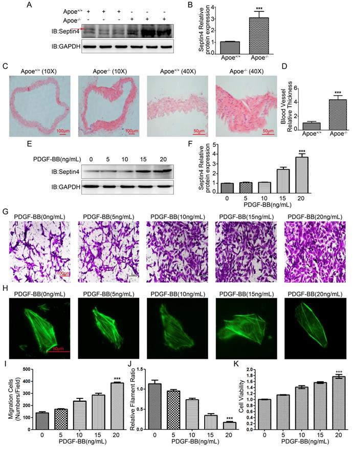 Septin4 Prevents PDGF-BB-induced HAVSMC Phenotypic Transformation ...