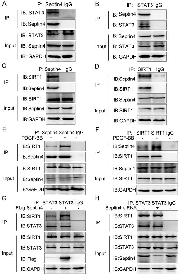 Septin4 Prevents PDGF-BB-induced HAVSMC Phenotypic Transformation ...