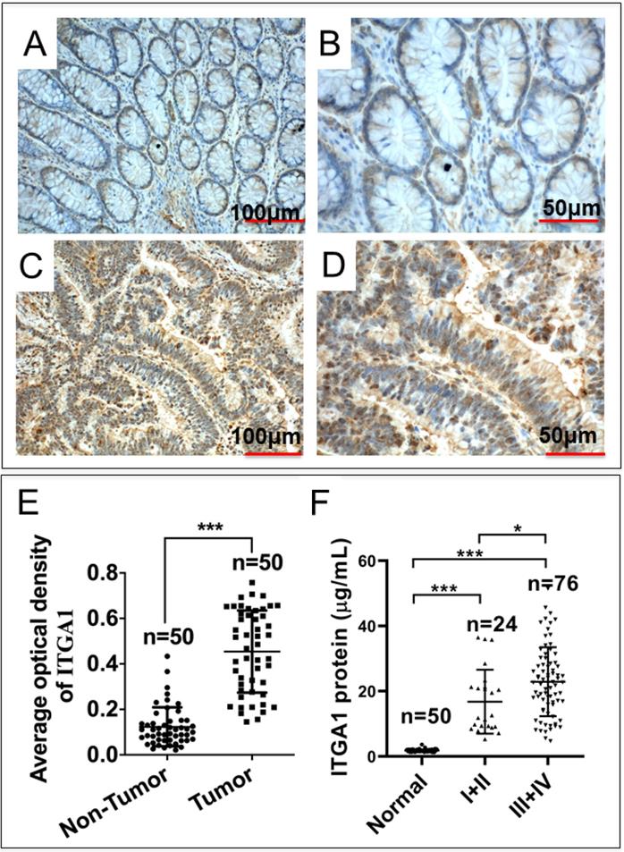 Integrin α1 promotes tumorigenicity and progressive capacity of ...