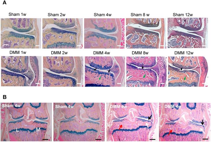 Acute Synovitis after Trauma Precedes and is Associated with ...