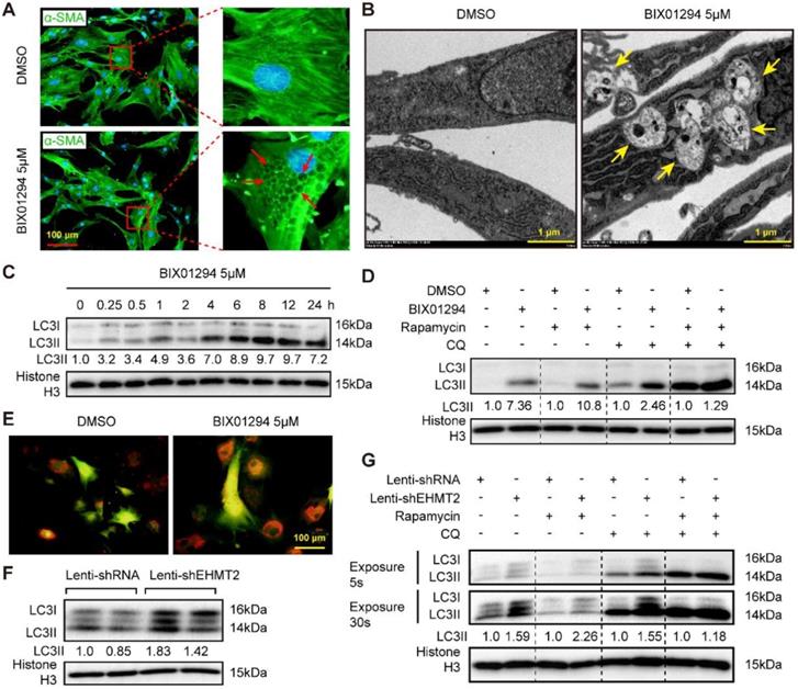 EHMT2/G9a Inhibits Aortic Smooth Muscle Cell Death by Suppressing ...