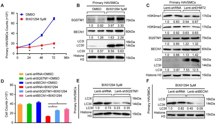 EHMT2/G9a Inhibits Aortic Smooth Muscle Cell Death by Suppressing ...