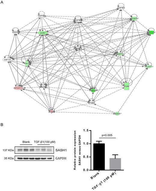 SASH1 promotes melanin synthesis and migration via suppression of TGF ...