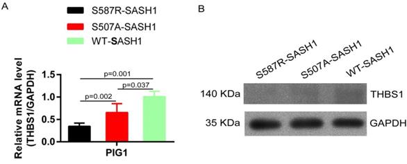 SASH1 promotes melanin synthesis and migration via suppression of TGF ...