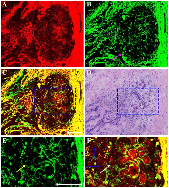 Label-free multiphoton imaging to assess neoadjuvant therapy responses ...