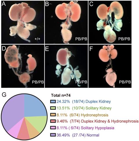 Gen1 mutation caused kidney hypoplasia and defective ureter-bladder ...