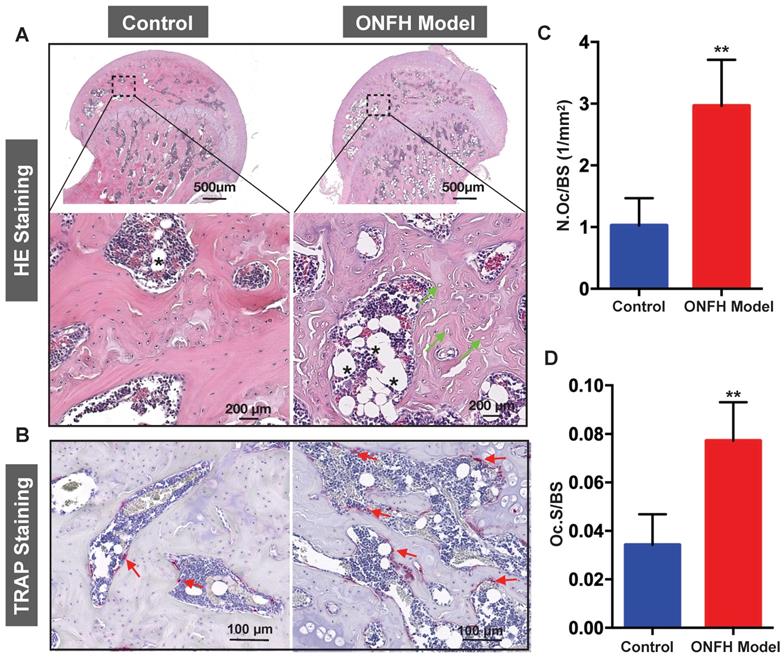 Steroid-induced osteonecrosis of the femoral head reveals enhanced ...