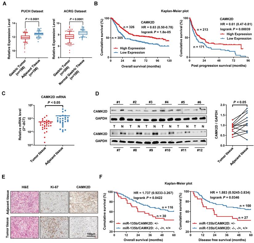 MicroRNA-135b/CAMK2D Axis Contribute to Malignant Progression of ...