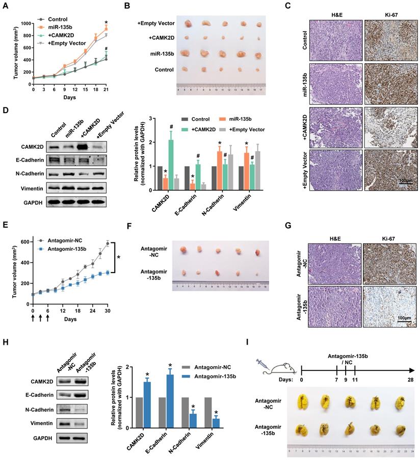 MicroRNA-135b/CAMK2D Axis Contribute to Malignant Progression of ...