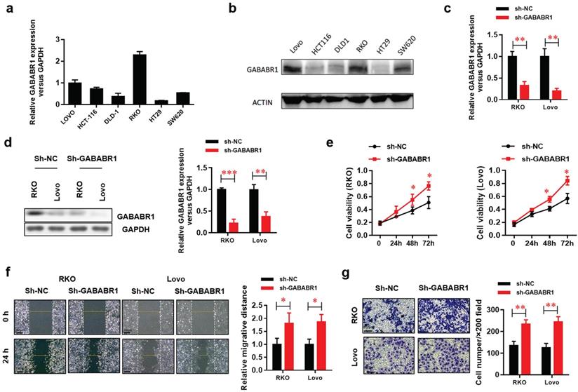 GABAB receptor inhibits tumor progression and epithelial-mesenchymal ...
