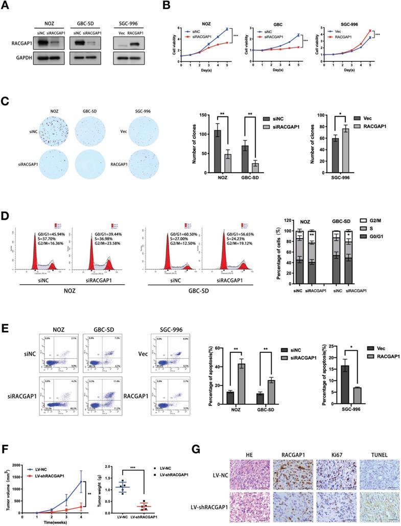 Rac GTPase activating protein 1 promotes gallbladder cancer via binding ...