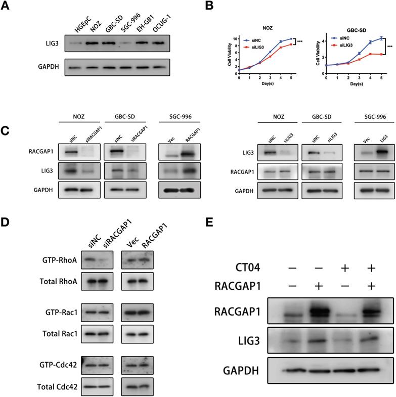 Rac GTPase activating protein 1 promotes gallbladder cancer via binding ...