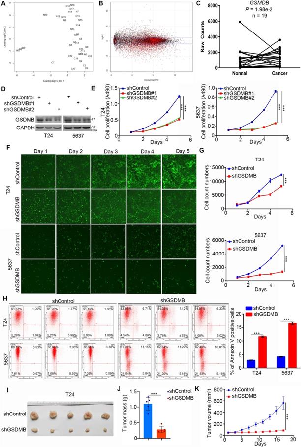 USP24-GSDMB complex promotes bladder cancer proliferation via ...