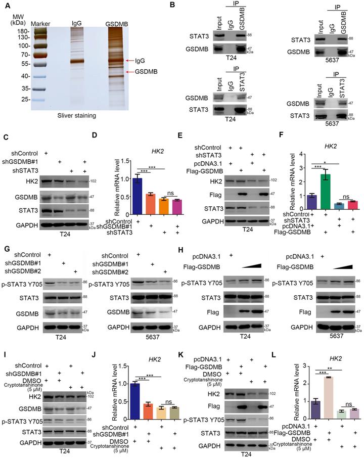 USP24-GSDMB complex promotes bladder cancer proliferation via ...