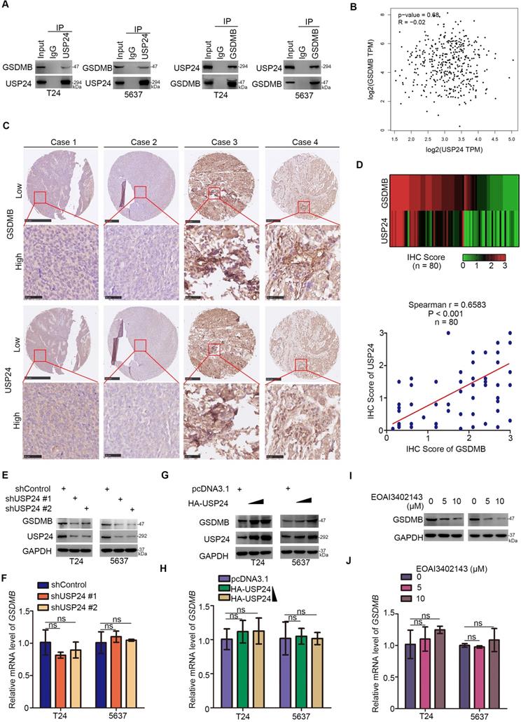 USP24-GSDMB complex promotes bladder cancer proliferation via ...