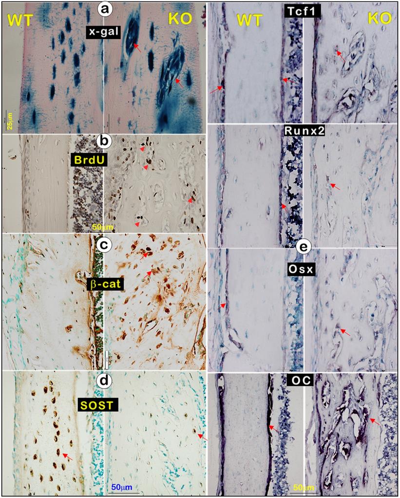 Osteocytes but not osteoblasts directly build mineralized bone structures