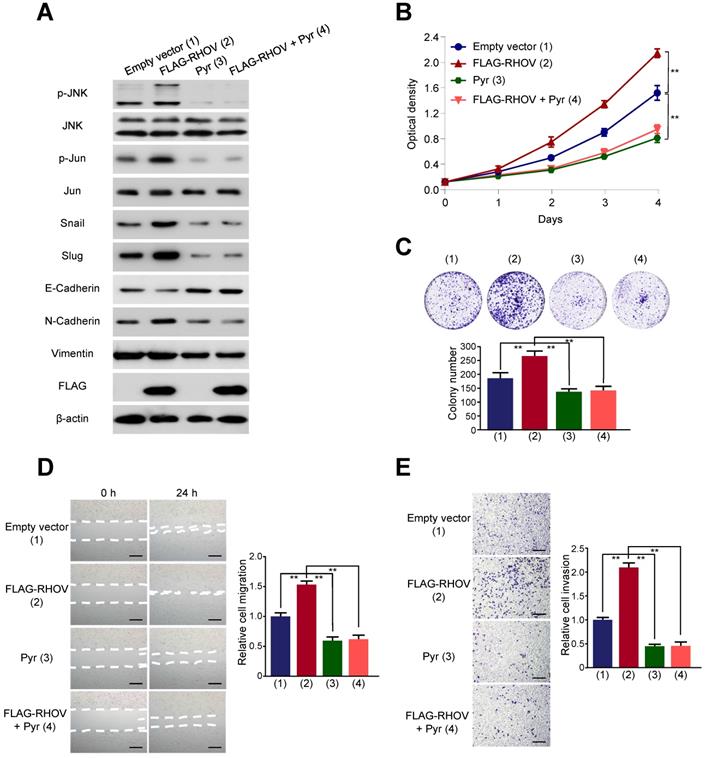 RHOV promotes lung adenocarcinoma cell growth and metastasis through ...