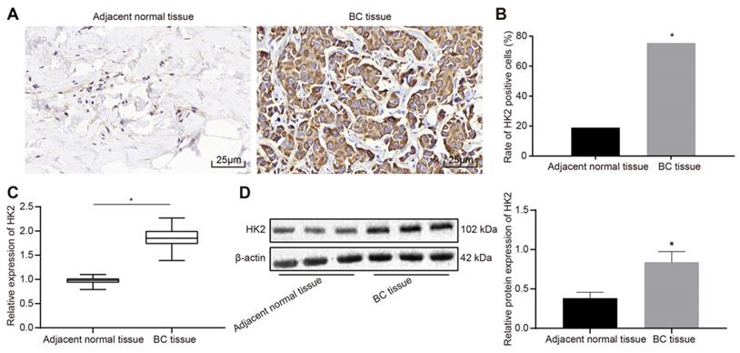 MicroRNA-216b targets HK2 to potentiate autophagy and apoptosis of ...