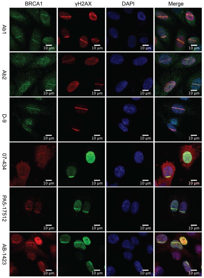 BRCA1 Antibodies Matter