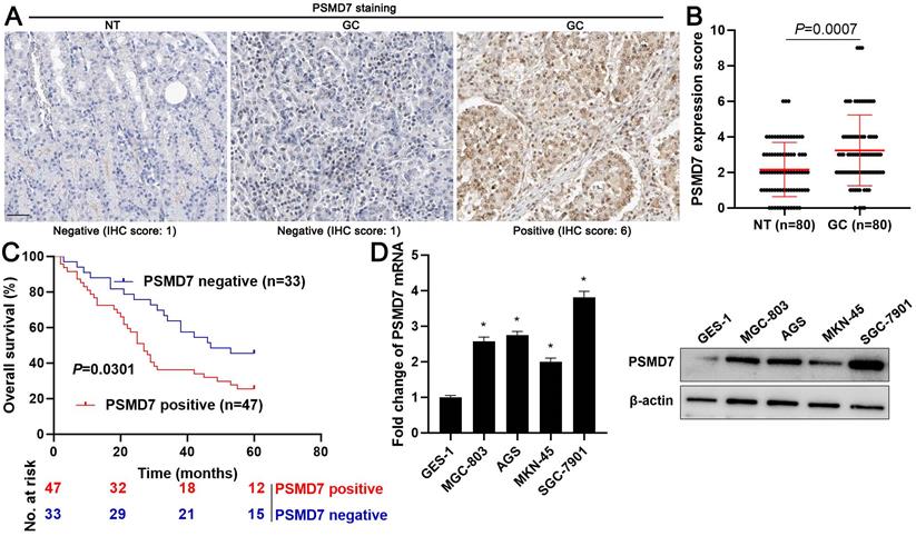 Deubiquitinase PSMD7 promotes the proliferation, invasion, and ...
