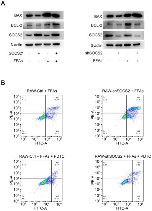 SOCS2 Suppresses Inflammation and Apoptosis during NASH Progression ...