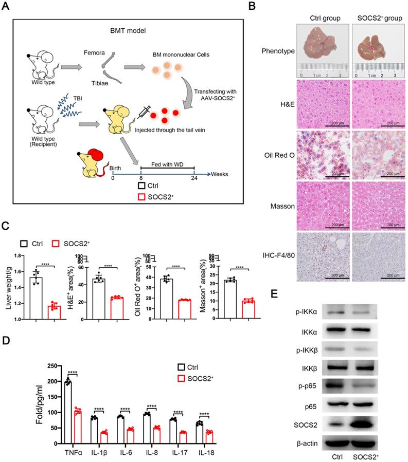 SOCS2 Suppresses Inflammation and Apoptosis during NASH Progression ...
