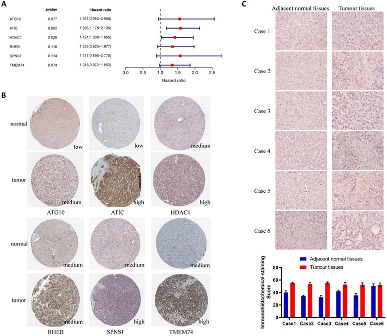 ATIC inhibits autophagy in hepatocellular cancer through the AKT/FOXO3 ...