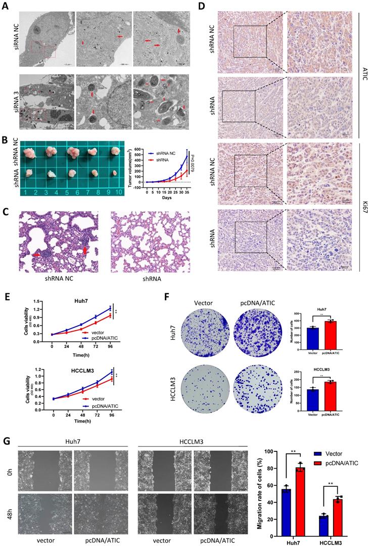 ATIC inhibits autophagy in hepatocellular cancer through the AKT/FOXO3 ...