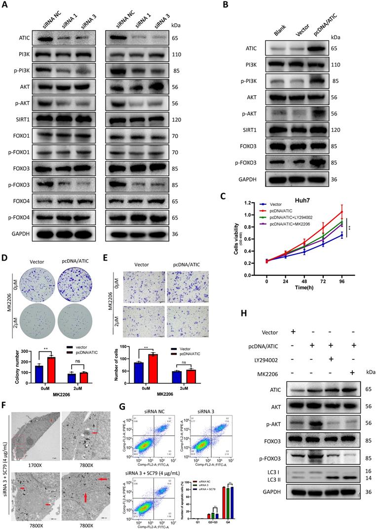 ATIC inhibits autophagy in hepatocellular cancer through the AKT/FOXO3 ...