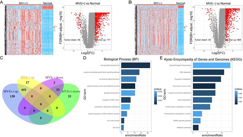 Identification and Validation of a Prognostic Model Based on Three MVI ...